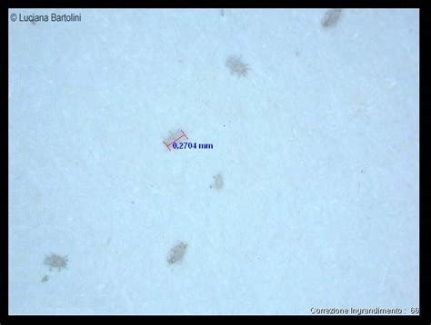 Gli Aracnidi Alla Classe Arachnida Appartengono Gli Acari Zecche Scorpioni Pseudoscorpioni E