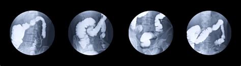 Basic C Arm Diagnosis To Improve Image Quality Amber Diagnostics