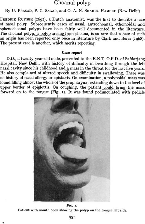 Choanal Polyp The Journal Of Laryngology And Otology Cambridge Core
