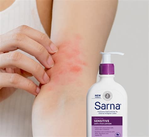 Sarna Sensitive Steroid Free Anti Itch Lotion Nea Accepted