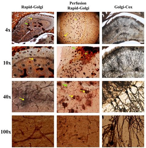 Photomicrographs Showing Of Different Types Of Golgi Staining Of