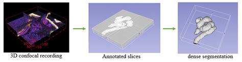 【论文】3d u net learning dense volumetric segmentation from sparse