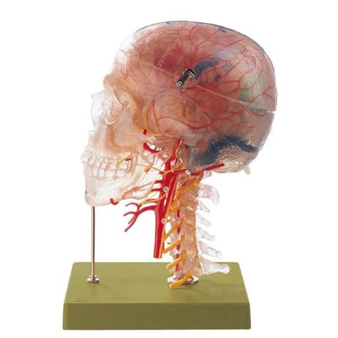 Somso Neuroanatomy Head Model