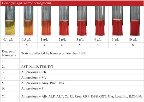 What Is Hemolysis Sample At Darlene Watson Blog