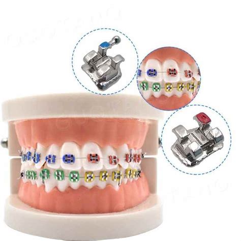 Orthodontic Brackets Dental Bondable Mini Orthodontic Roth Metal
