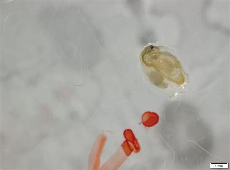 Daphnia Segmentation Length Object Detection Dataset And Pre Trained Model By Image Processing