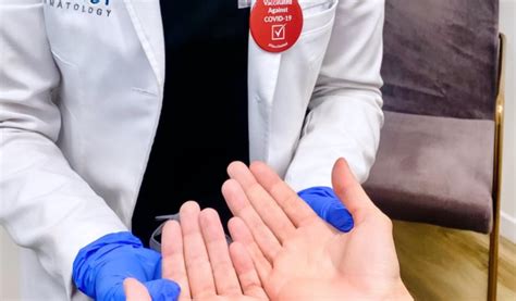 Hyperhidrosis Examples