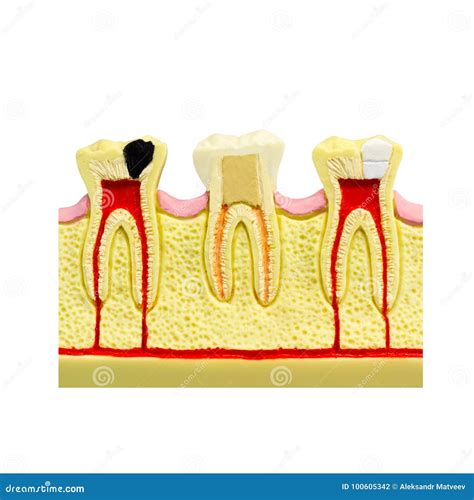 Human Tooth Gum Cross Section Tooth Root Canal Tooth Detailed Anatomy