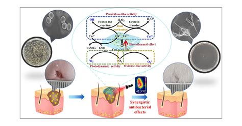 Nanoarchitectonics Of Bimetallic Cu Co Doped Nitrogencarbon Nanozyme Functionalized Hydrogel
