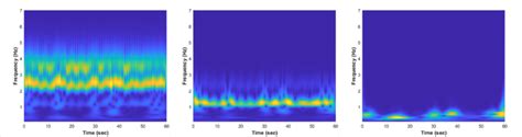 the emd cwt spectrogram results of apnea episode preprocessed ecg