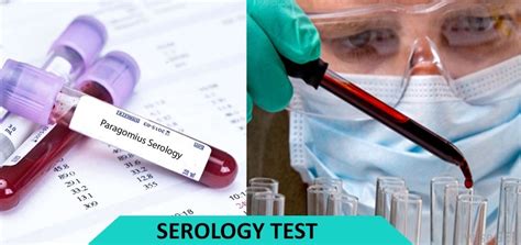 Serological Tests