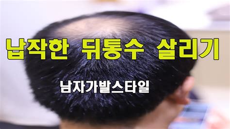 납작한 뒤통수 살리기 남자가발스타일 Youtube