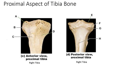 Proximal Aspect Of The Tibia Bony Landmarks Diagram Quizlet