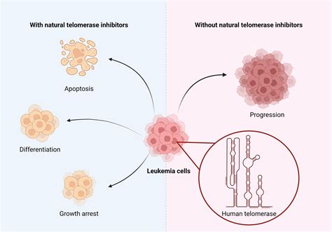 Leukemia Cells Diagram