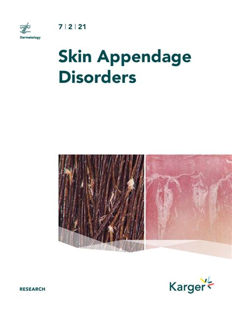 Subungual Invasive Squamous Cell Carcinoma With Doubtful Underlying Bone Invasion A Treatment