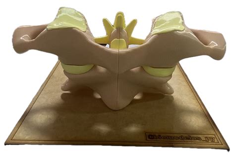 🎒 Anatomy Atlanto Occipital Joint・ Stl File For 3d Printing・cults