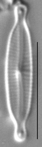 Compare Encyonopsis Neerlandica Species Diatoms Of North America