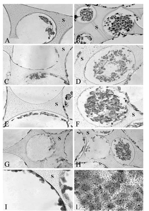 Histological Sections Of Three Dimensional Bone Like Constructs Download Scientific Diagram