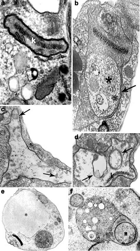 Drugs Targeting Parasite Mitochondria Untreated L Amazonensis