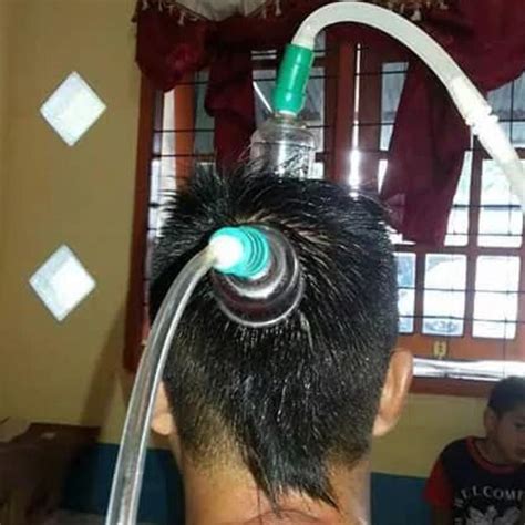 Jual Mesin Bekam Kepala Tanpa Cukur Rambut Shopee Indonesia