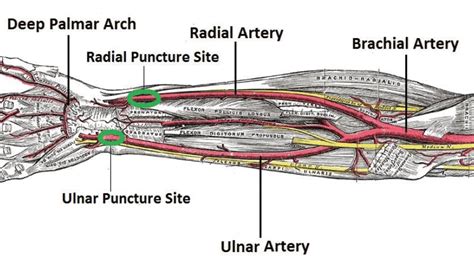Cardiac Interventions Today Ulnar Access For Catheterization And
