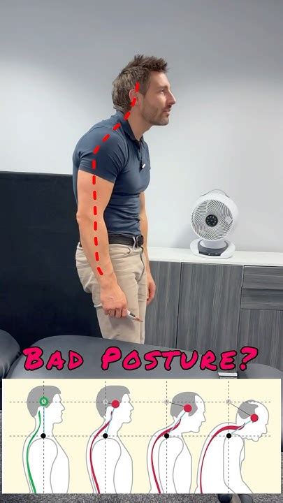 How To Fix Your Posture Posture Posturecorrection Postureexercises Youtube