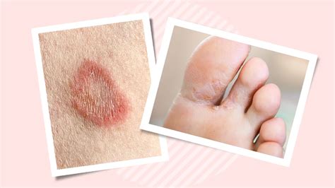 9 Dos And Donts To Know About Washing Your Feet