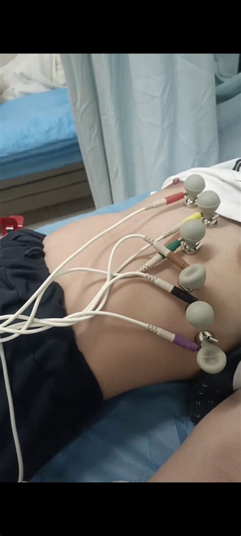 Chinese Wowen Ecg Exam