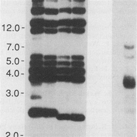 Hybridization Of Rp A To Ecori Digested Genomic Dna From Four Download Scientific Diagram