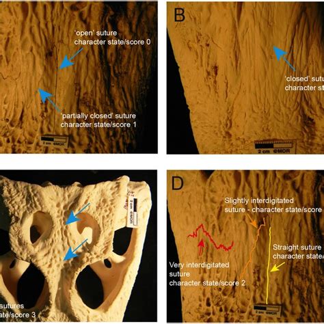 Transverse Sections Through The Frontoparietal Suture The Internasal