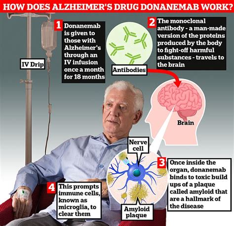 How Does The Alzheimers Drug Donanemab Work And When Will It Be