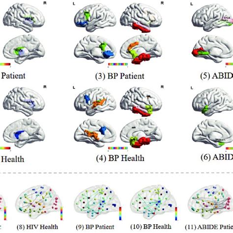 A Part Is Visualization Results Of Salient Brain Regions With Download Scientific Diagram