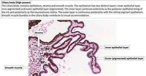 Eye Iris And Ciliary Body Nus Pathweb Nus Pathweb