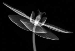 X Ray Art Learn Everything About X Ray Art