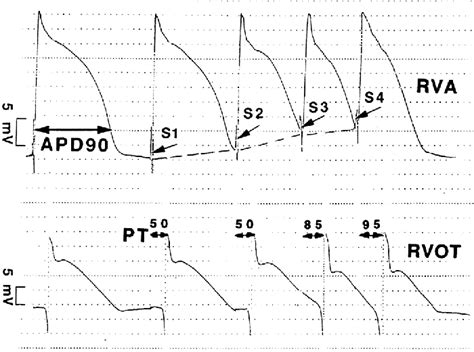 figure 1 from a model for human action potential dynamics in vivo