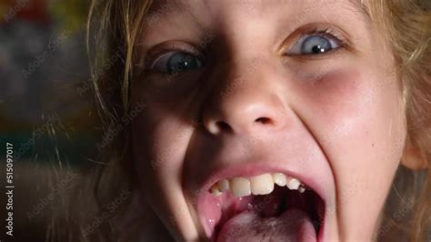 Blue Eyed Girl Firmly Clenches Her Teeth Then Opens Her Mouth Wide