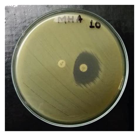 Inducible Clindamycin Resistant D Test Isolate No 10 Download