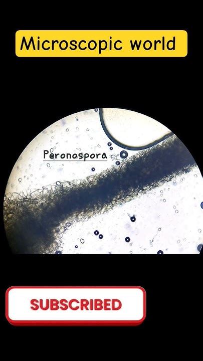 Peronospora Leaf Killer Fungus Under Microscope 🦠🌿