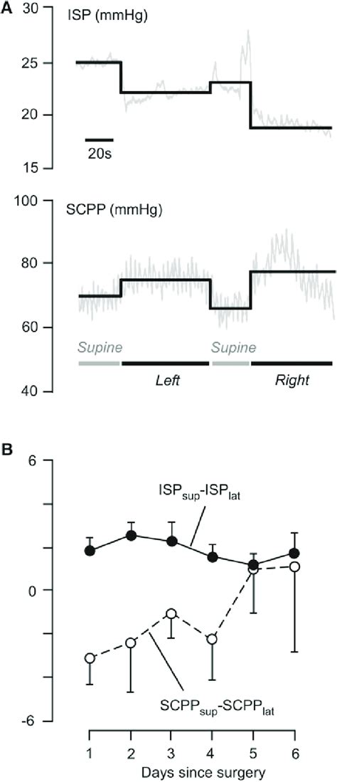 Intraspinal Pressure Isp And Spinal Cord Perfusion Pressure Scpp In