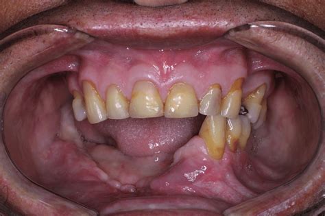 Post Surgical After 07 Months Download Scientific Diagram