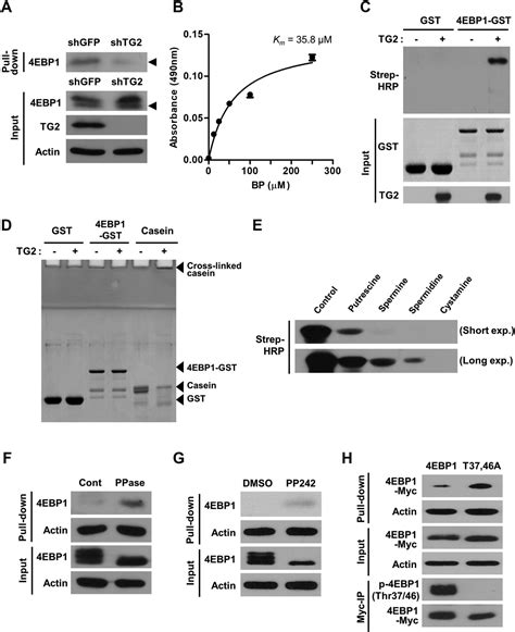 Transglutaminase 2 Mediates Hypoxia Induced Selective Mrna Translation