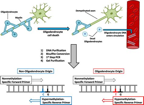 Multiple Sclerosis Myelin