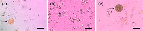 Parasites Were Found In A Stool Sample Under The Microscope A