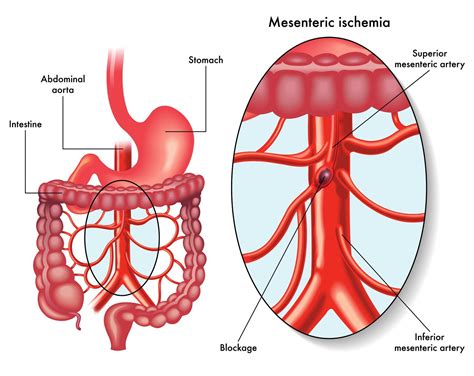 Superior Mesenteric Artery