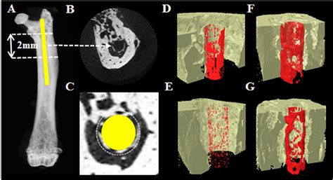 Qualitative Micro Ct Analysis Of Fgf18 Stimulated Peri Implant Bone Download Scientific Diagram