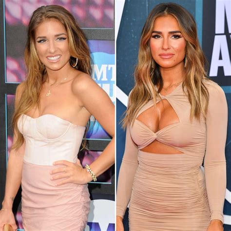 Jessie James Decker Plastic Surgery Procedures Quotes Life And Style