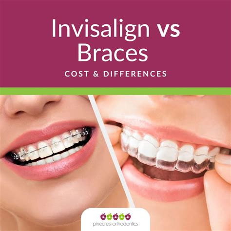 Invisalign Vs Braces Invisalign Vs Braces An Overview Of Orthodontic