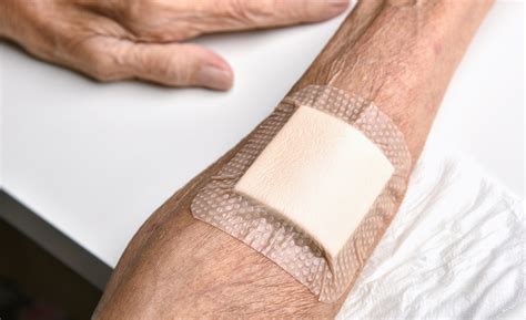 Psa Wound Dressing Adhesion And Skin Type A Delicate Balance
