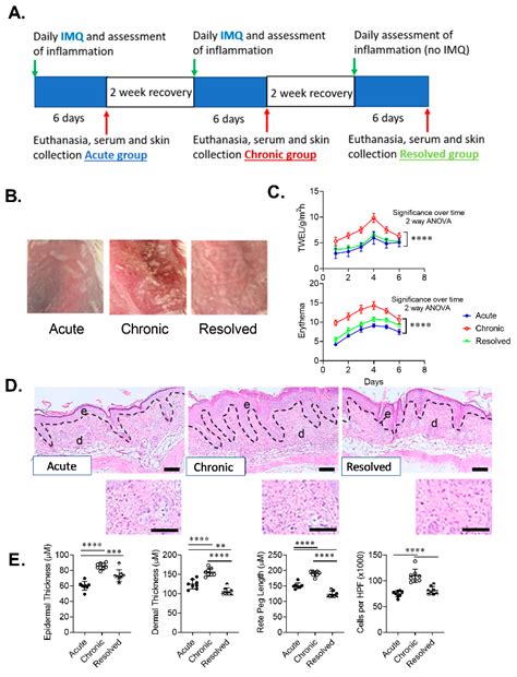 Immunological Memory In Imiquimod Induced Murine Model Of Psoriasiform
