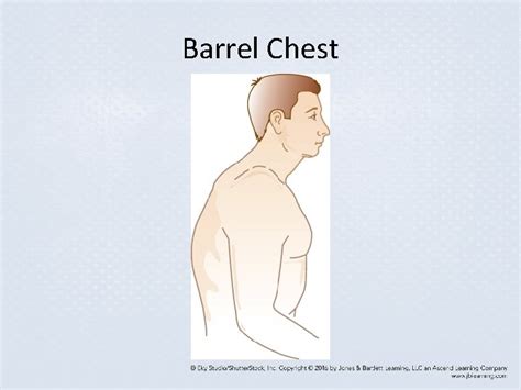 Chapter 1 History And Physical Examination Objectives 1
